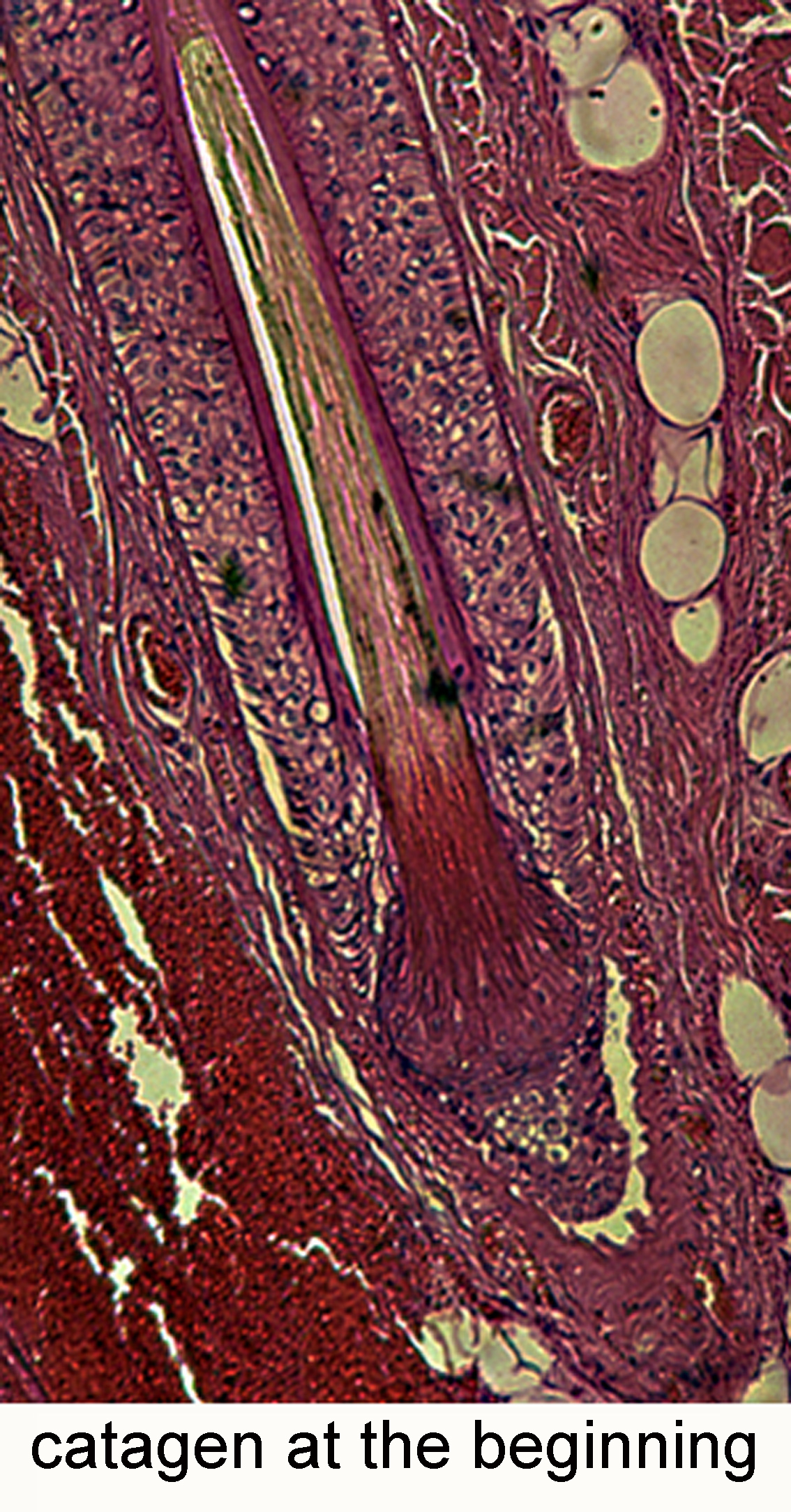 The Duration of the Catagen Phase - Società Italiana di Tricologia